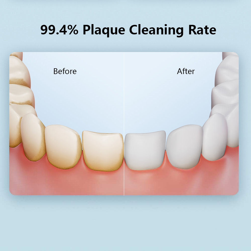 Xiaomi Mijia Portable Water Flosser F300 4 Speed High Frequency Pulse ...