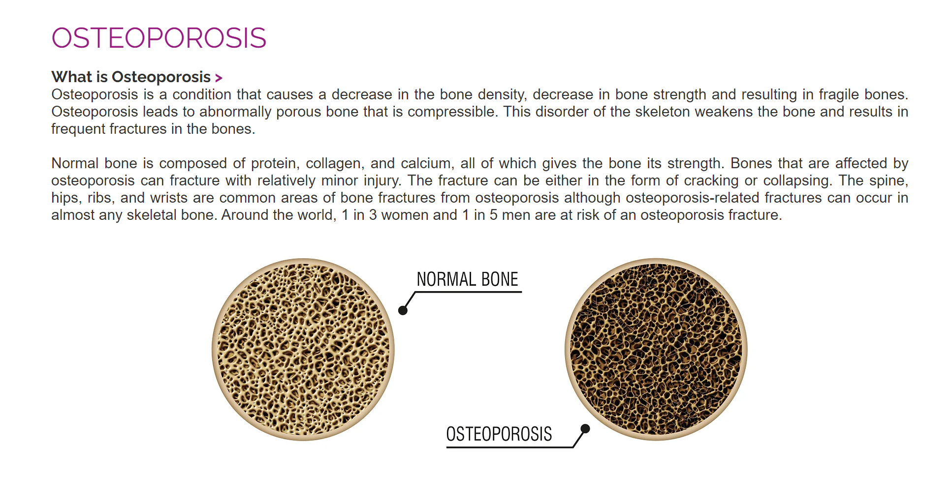 【HALAL-CERTIFIED】BREGO SelecK2 Complex 60 Tablets [HEALTHY BONES AND ...
