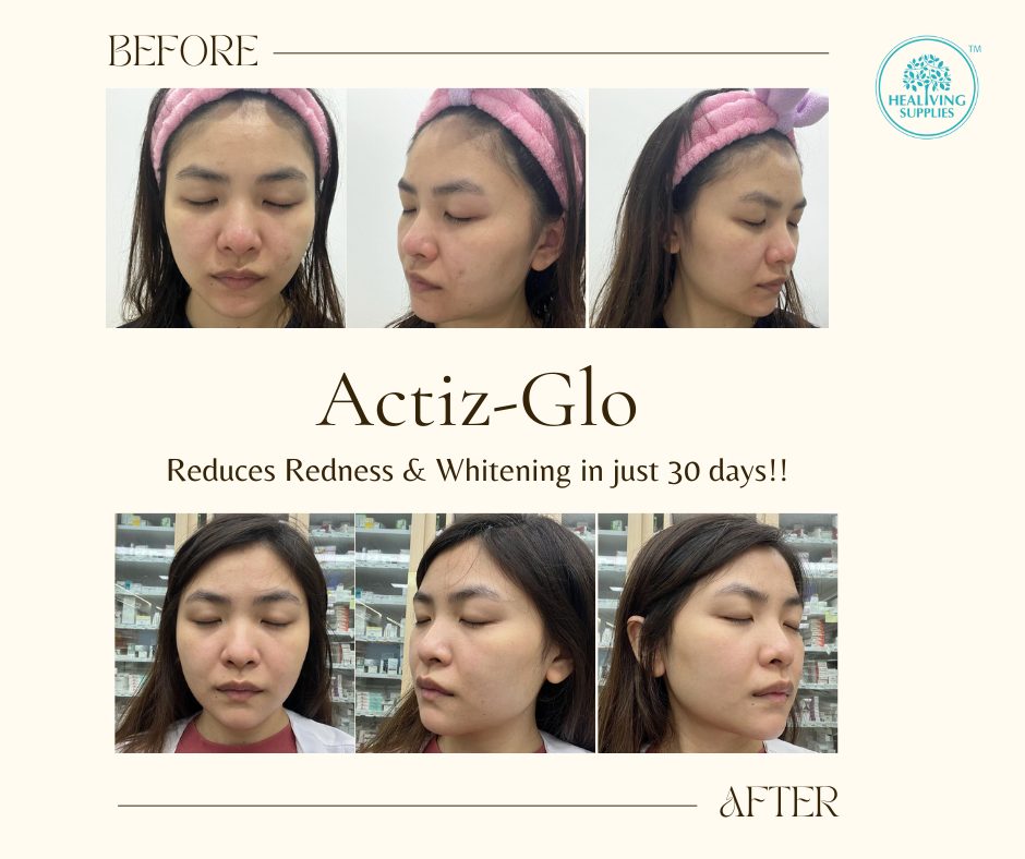 Healiving Supplies Actiz-Glo 30 tablets x 800mg (EXP 09/2026) | L ...