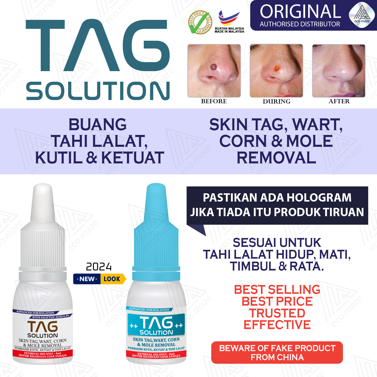 Skin Tag, Mole, Wart & Corn Removal 8ml - Buang Tahi Lalat, Ketuat ...