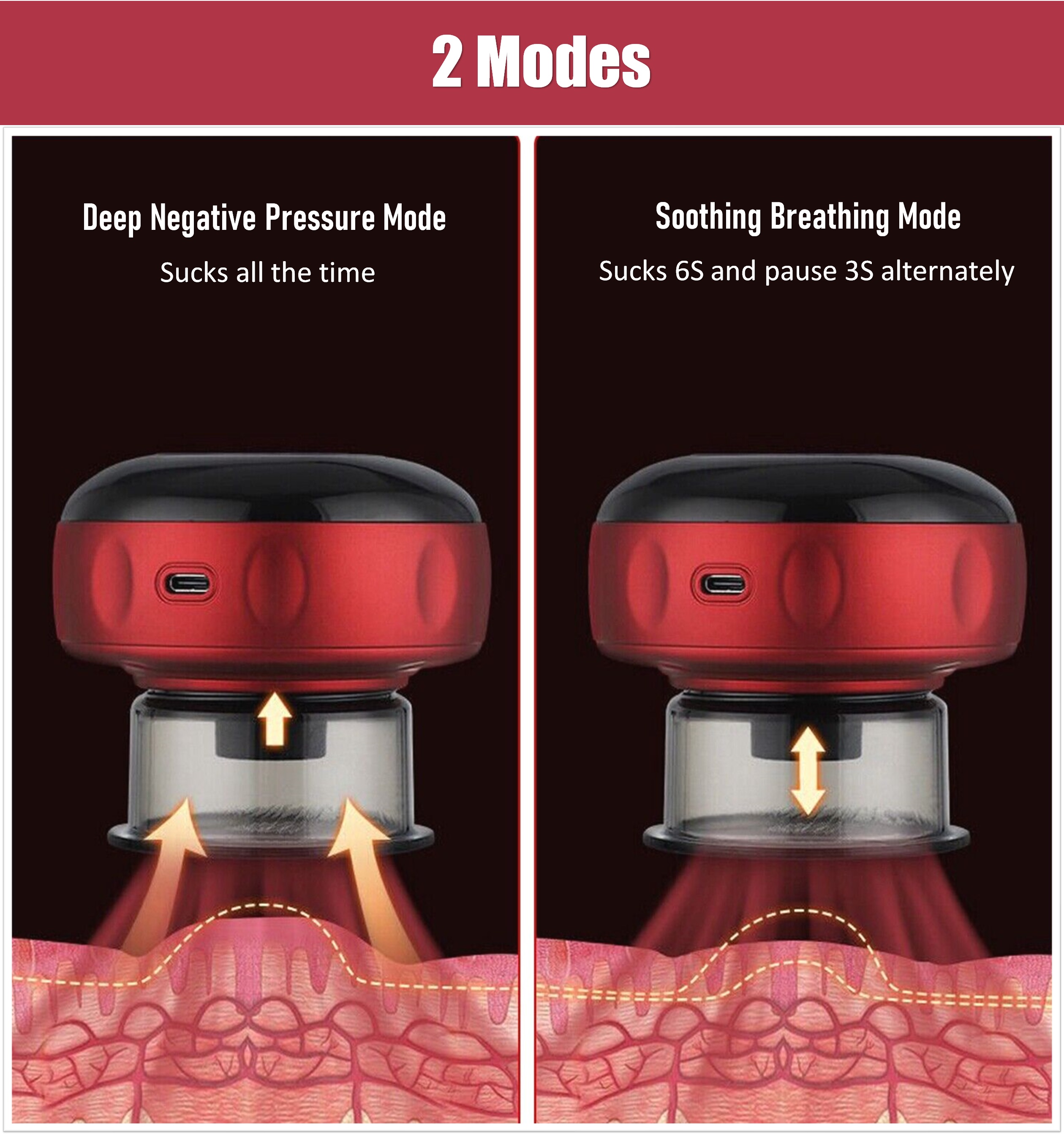 Intelligent Electric Cupping Guasha Scraping Heating Massage Body Cups ...