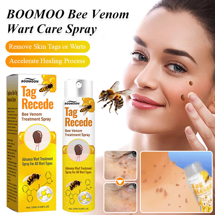 Tag Recede Bee Venom Spary Wart Remover buang tahi lalat Ubat kutil ...