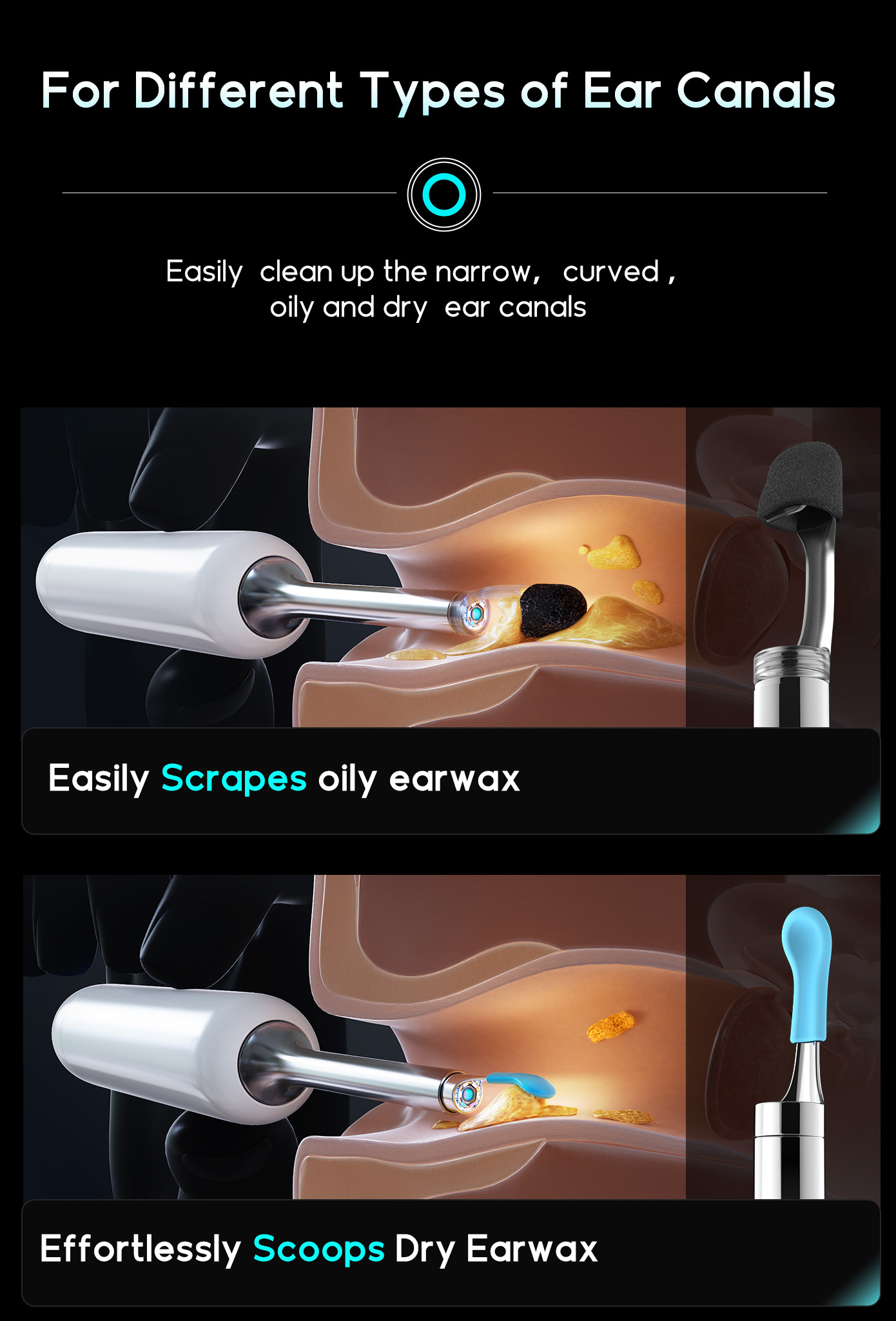 Bebird HOME 30S H30S Visual Ear Wax Remover AI Ear Care Assistant Kit 4 ...