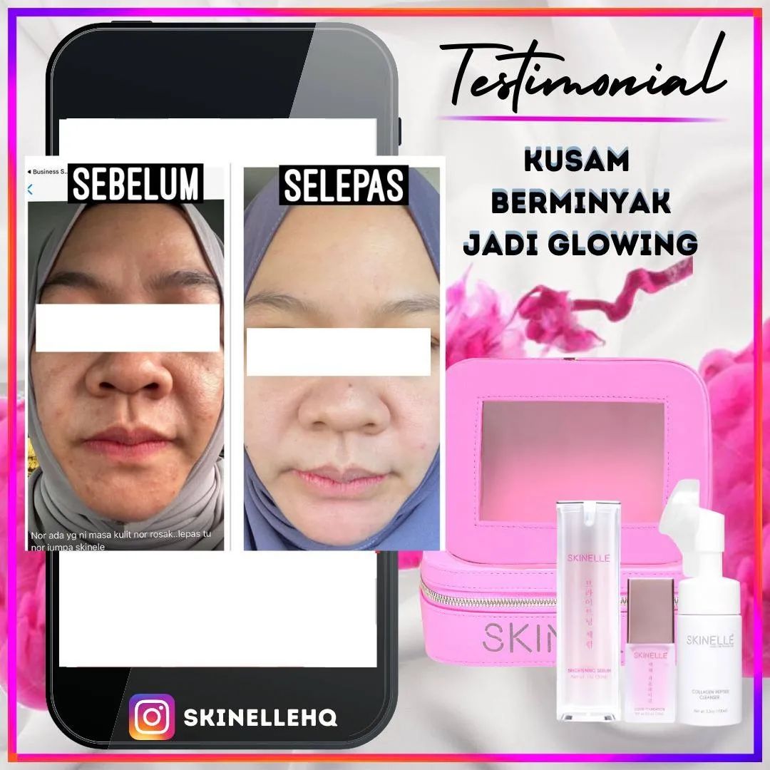 [FAST SHIP] SKINELLE SET JERUNG SET BTS COMBO FOUNDATION SKINELLE ...