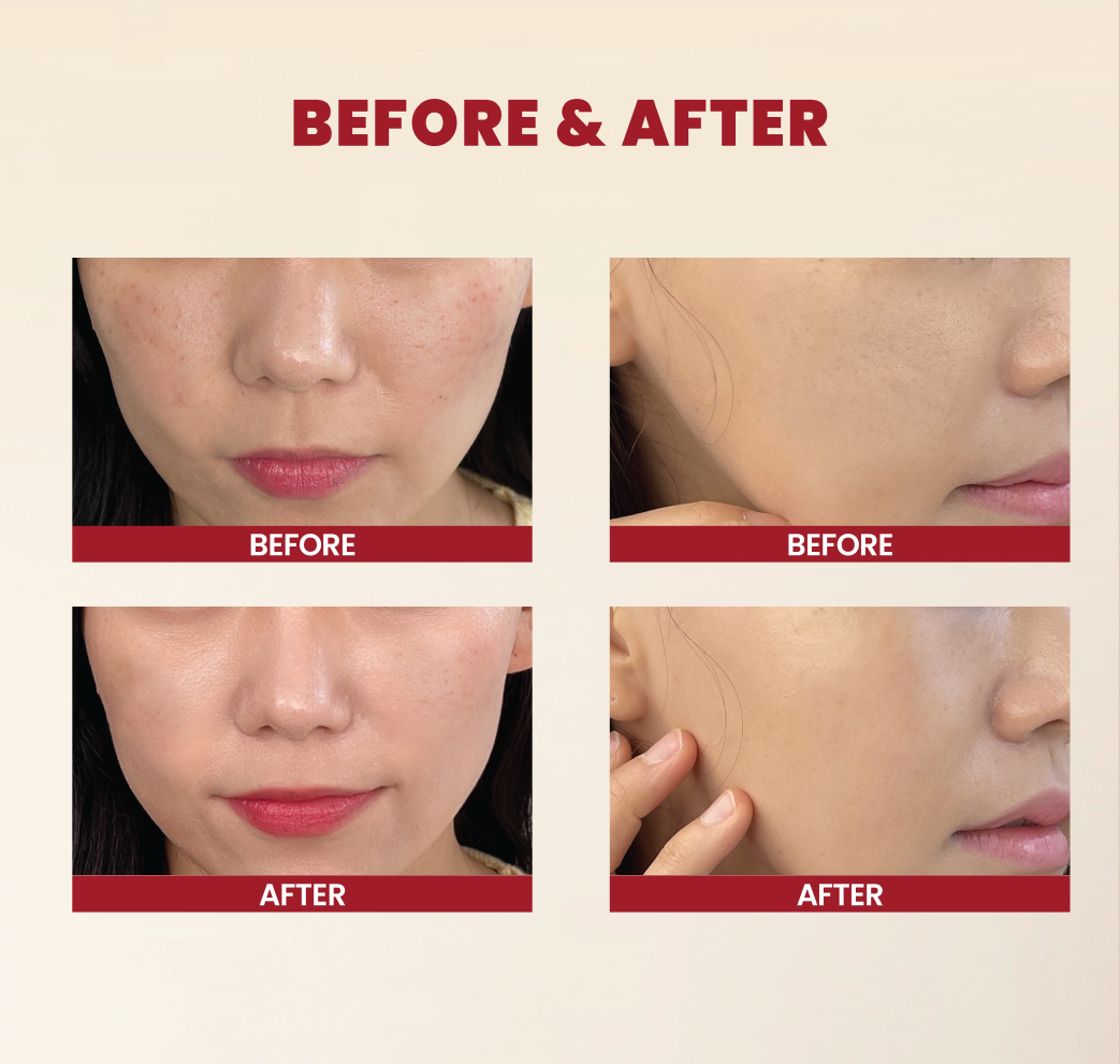 K-SECRET SEOUL 1988 ESSENCE Snail Mucin 97%+Rice 100ml/Sunscreen Pine Tree+Ceramide 50ml/Snail ...