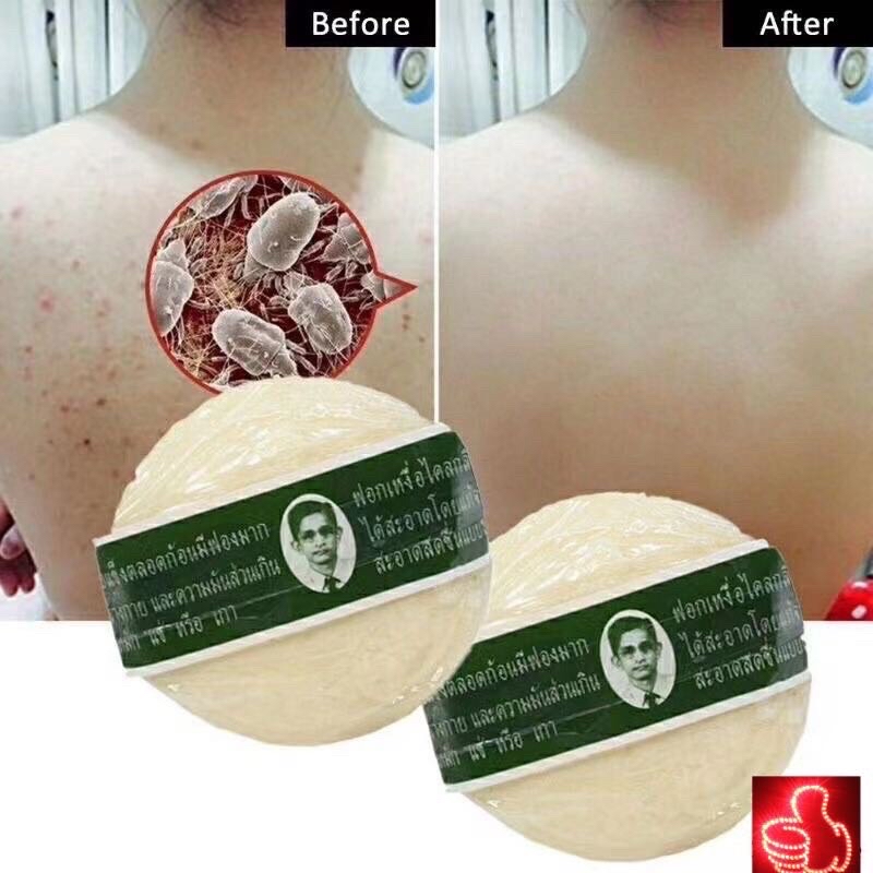RAWRA HERBAL DISTILLED SOAP 170g🇹🇭 ORIGINAL💯 | Shopee Malaysia