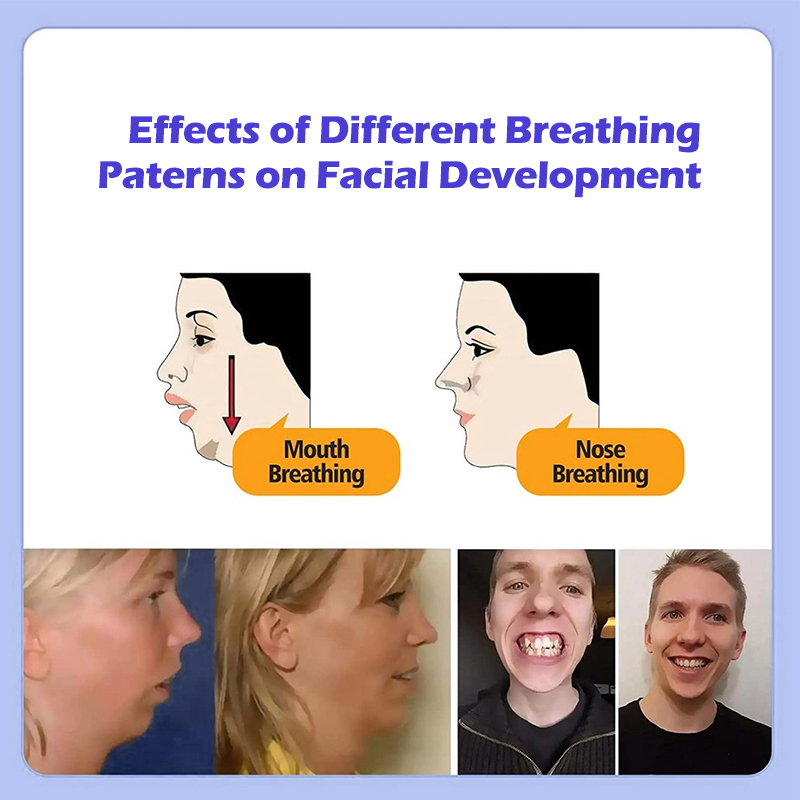 30Pcs/Box Anti Snore Anti-open mouth Breathing Patch Dream Talking ...