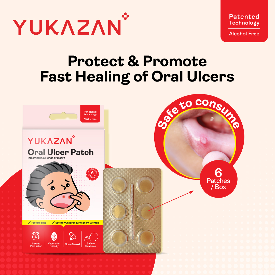 Yukazan Oral Ulcer Patch (6 pieces) - For all kind of oral & canker ...
