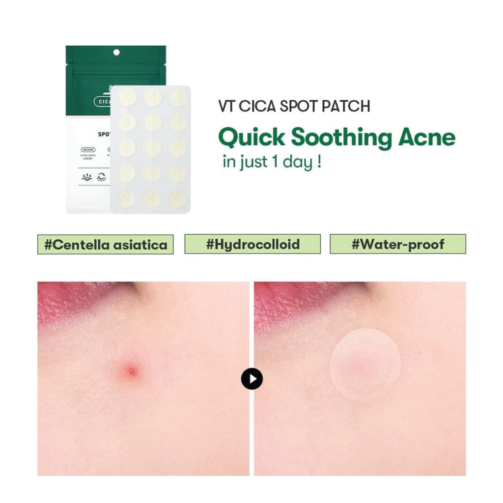 VT Cica Spot Patch Acne Patch Pimple Patch (48pcs) | Shopee Malaysia