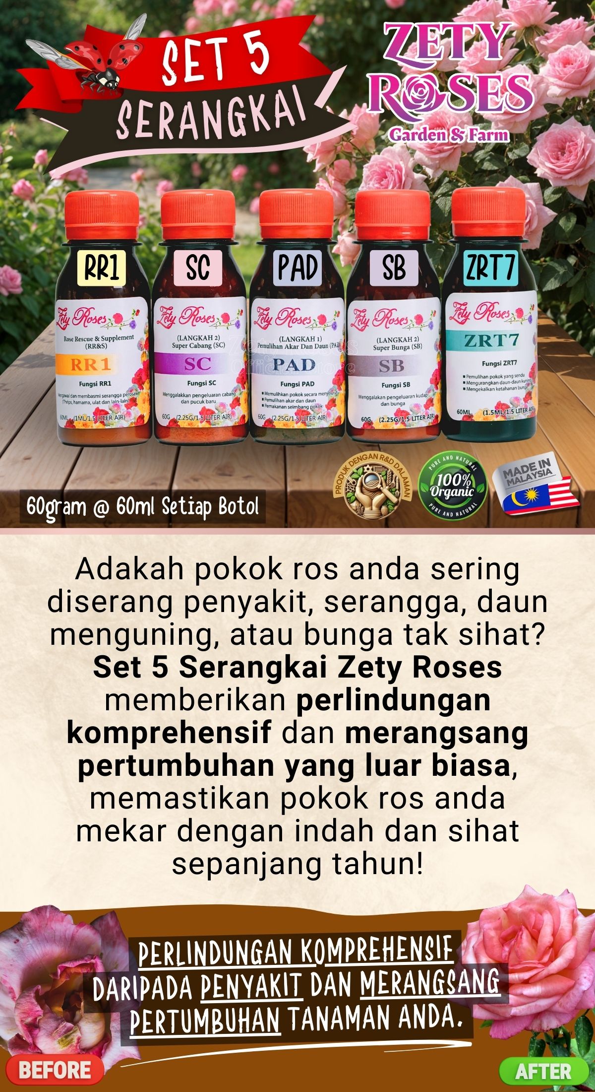Zety Roses Set 5 Serangkai Perlindungan Komprehensif Penyakit Pokok ...