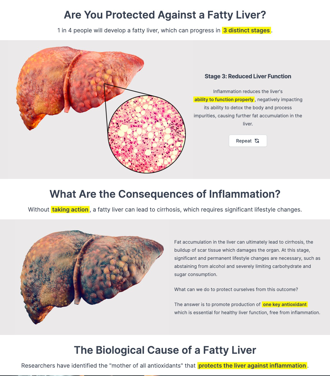 GENUINE HEPAGARD Natural Liver Support Supplement Capsule with N-Acetyl ...