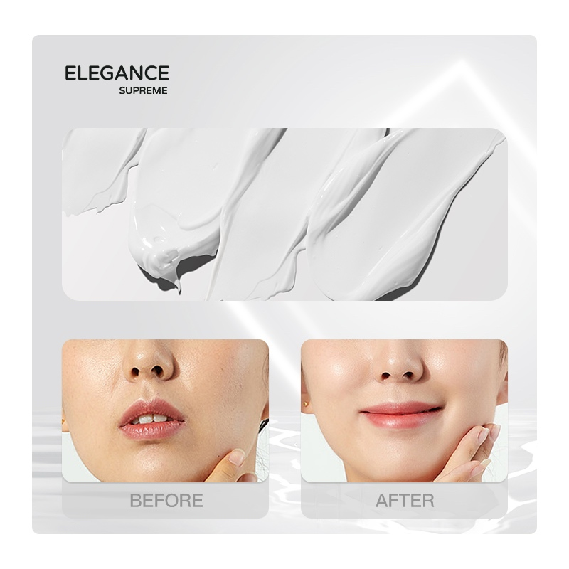 Elegance Supreme 5X Ceramide Low pH Gentle Cleanser Facial Wash (15 ...