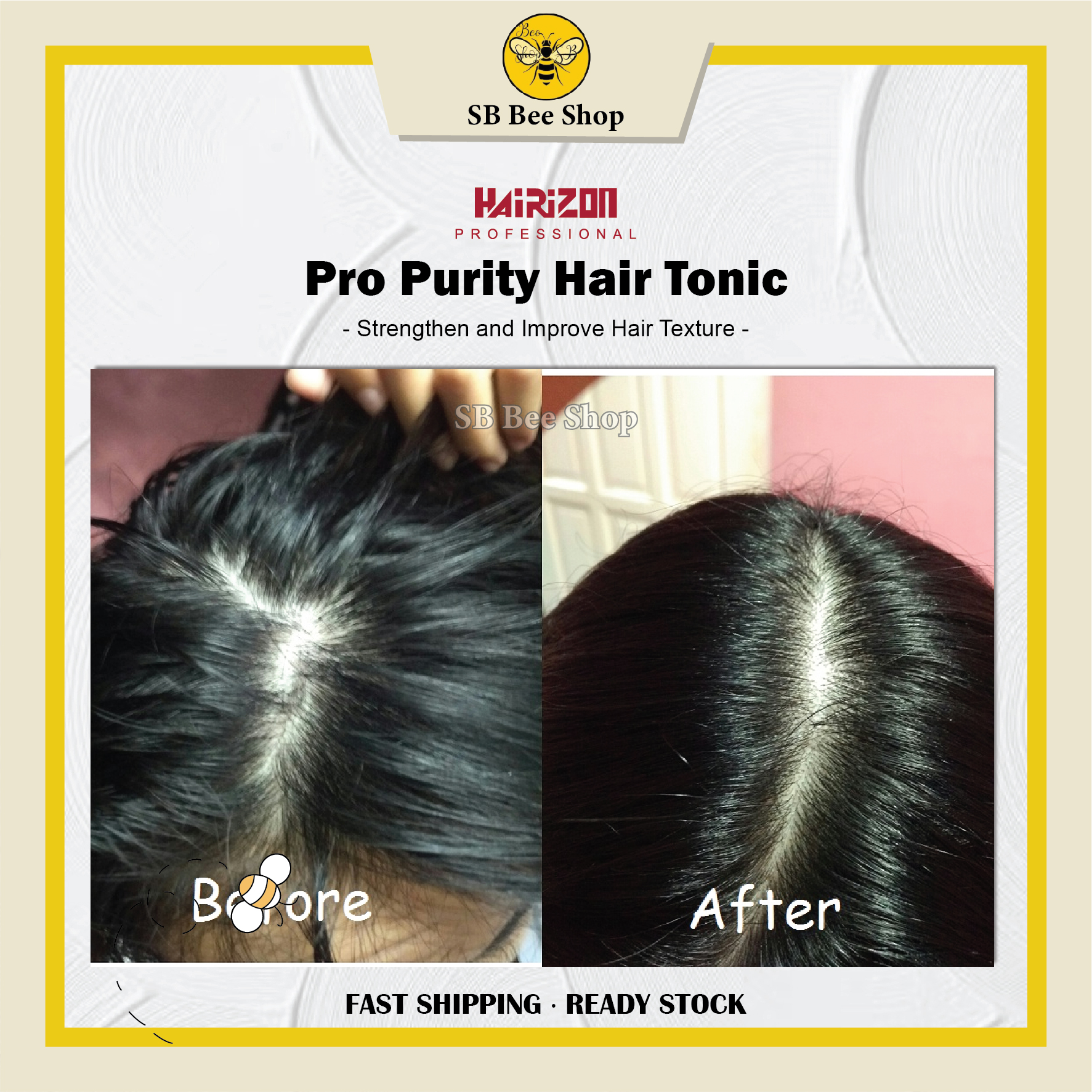 Hairizon Pro Purity Hair Tonic 140ml | Shopee Malaysia