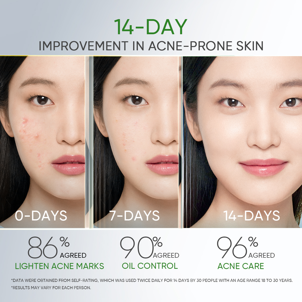 SKINTIFIC 3X Acid Anti-Acne Gel Moisturizer Acne Repair Moisturiser Oil ...