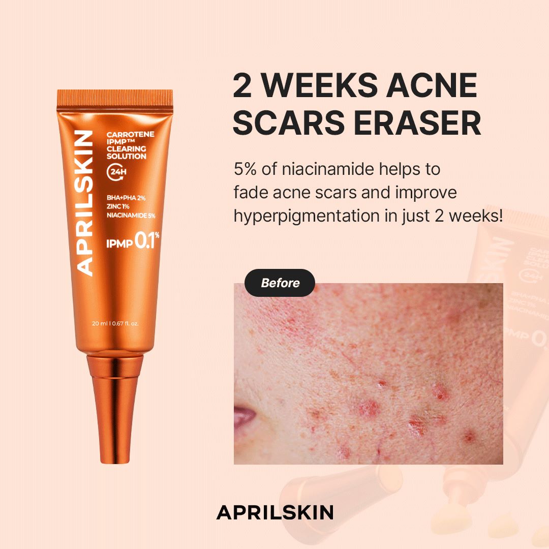 [APRILSKIN OFFICIAL] Carrotene IPMP Clearing Solution | Acne Treatment ...