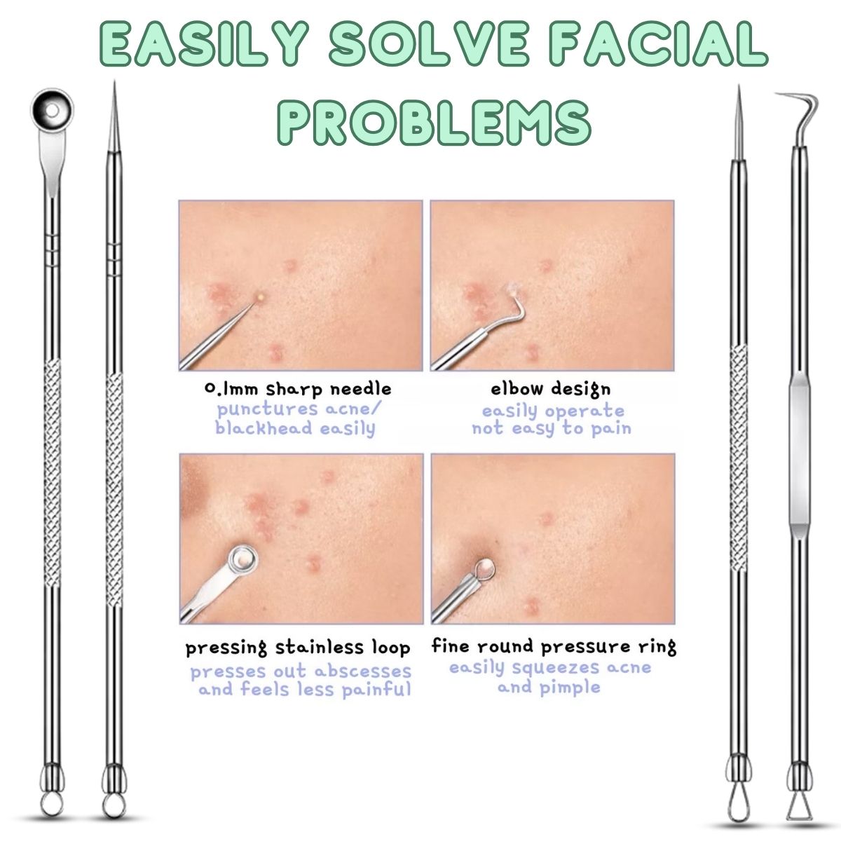 [MALAYSIA READY STOCK] Home Park Pimple Kit Set Besi Picit Jerawat Acne ...