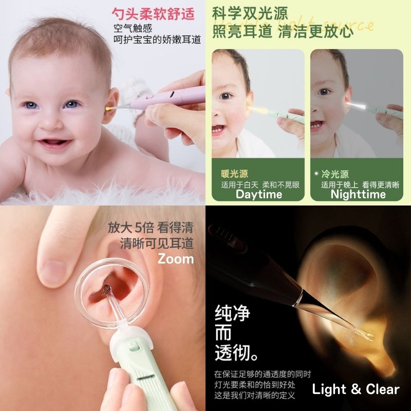 🐳 Penyepit Telinga Pembersih Lilin Telinga dengan Lampu Suluh LED Ear ...