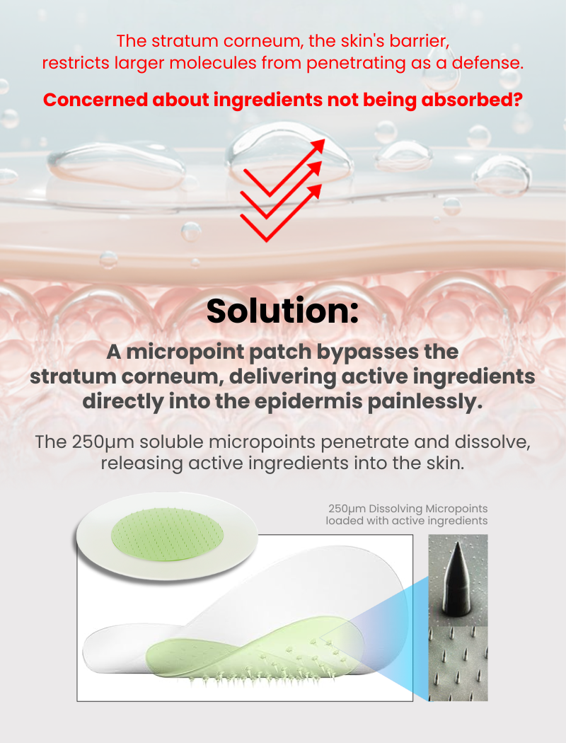 NOLAHOUR Micropoint Patch for early acne spot with CICA, Salicylic Acid ...
