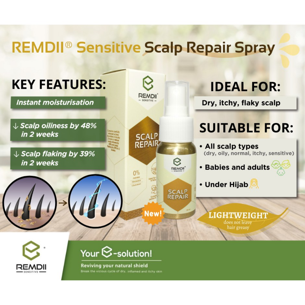 Remdii Sensitive Scalp Repair Spray (30ml) Dry, Red, Itchy & Flaky ...