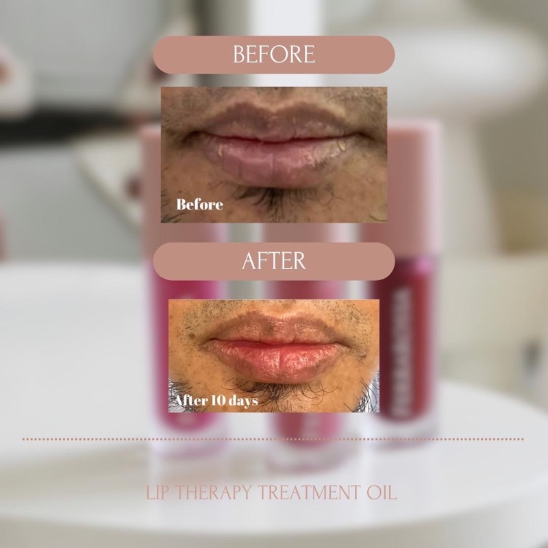 FERRAROSSA LIP OIL TREATMENT & THERAPY (3 COLOURS & FLAVOUR) | Shopee ...