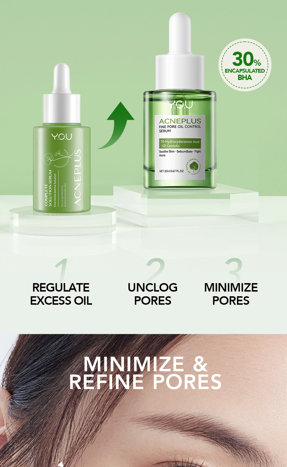 [UPGRADED] YOU AcnePlus Fine Pore Oil Control Serum with 4D Centella ...
