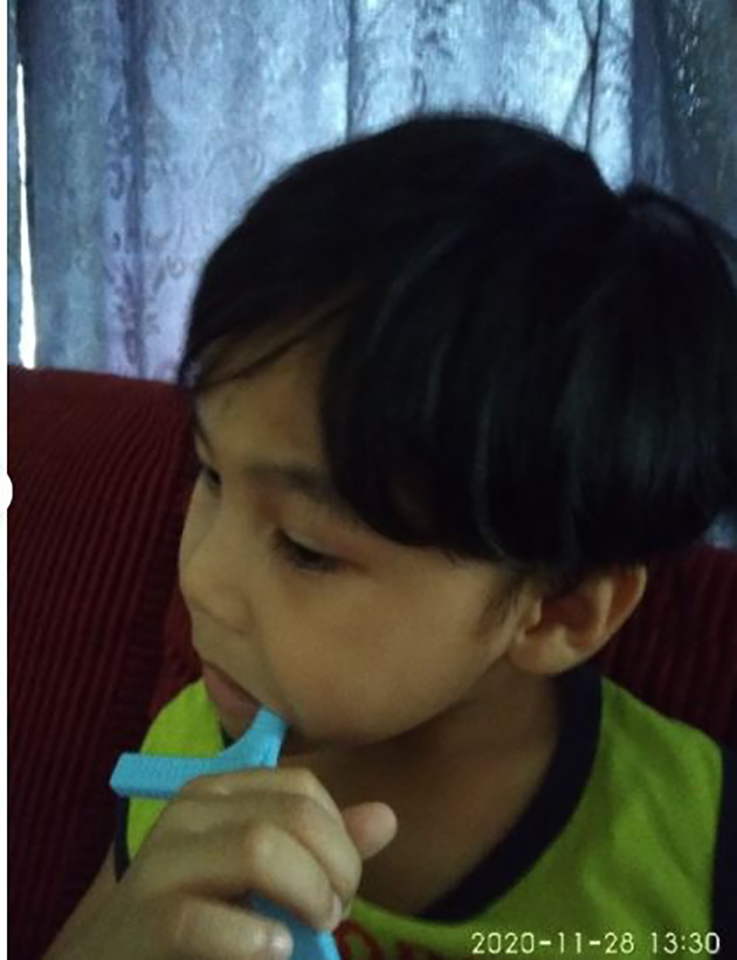 ARK's Y-Chew Oral Motor Chewy Speech Delay Oral Therapy Autism | Shopee ...
