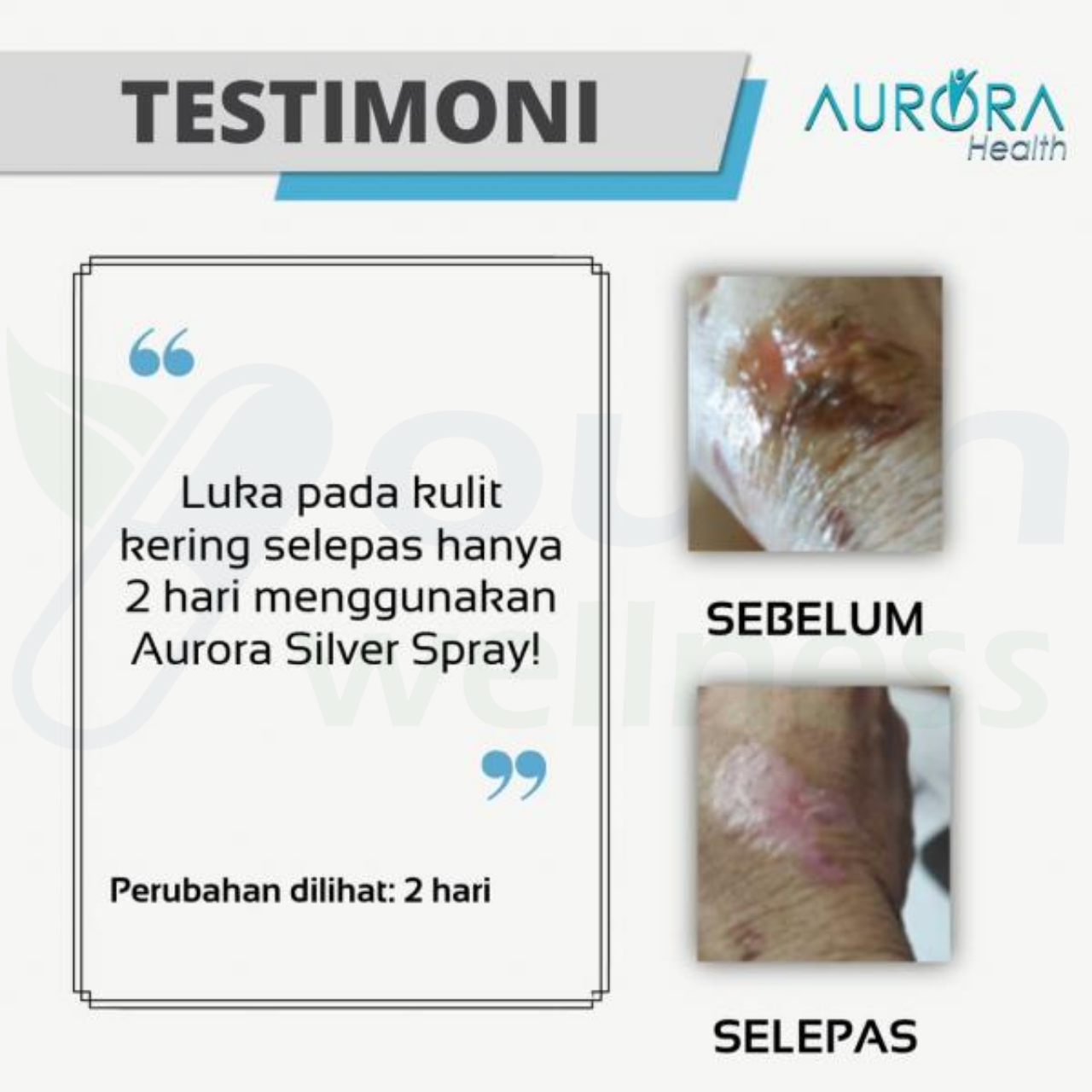 Remdii Aurora Silver Multipurpose Skin Spray (30 / 90 ml) Nano ...