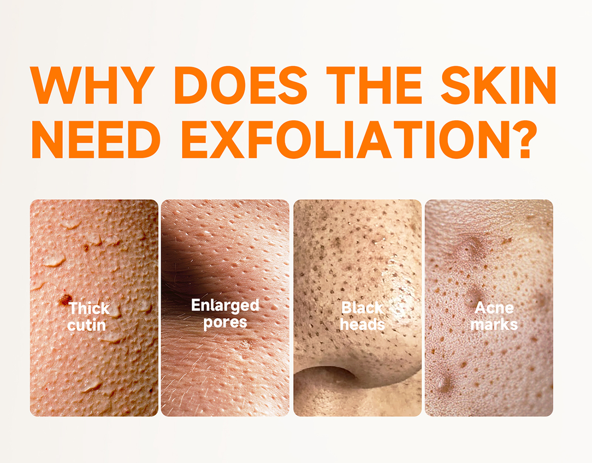 【Official】GMEELAN Exfoliate Whitening Gel Face Scrub Peeling Solution ...