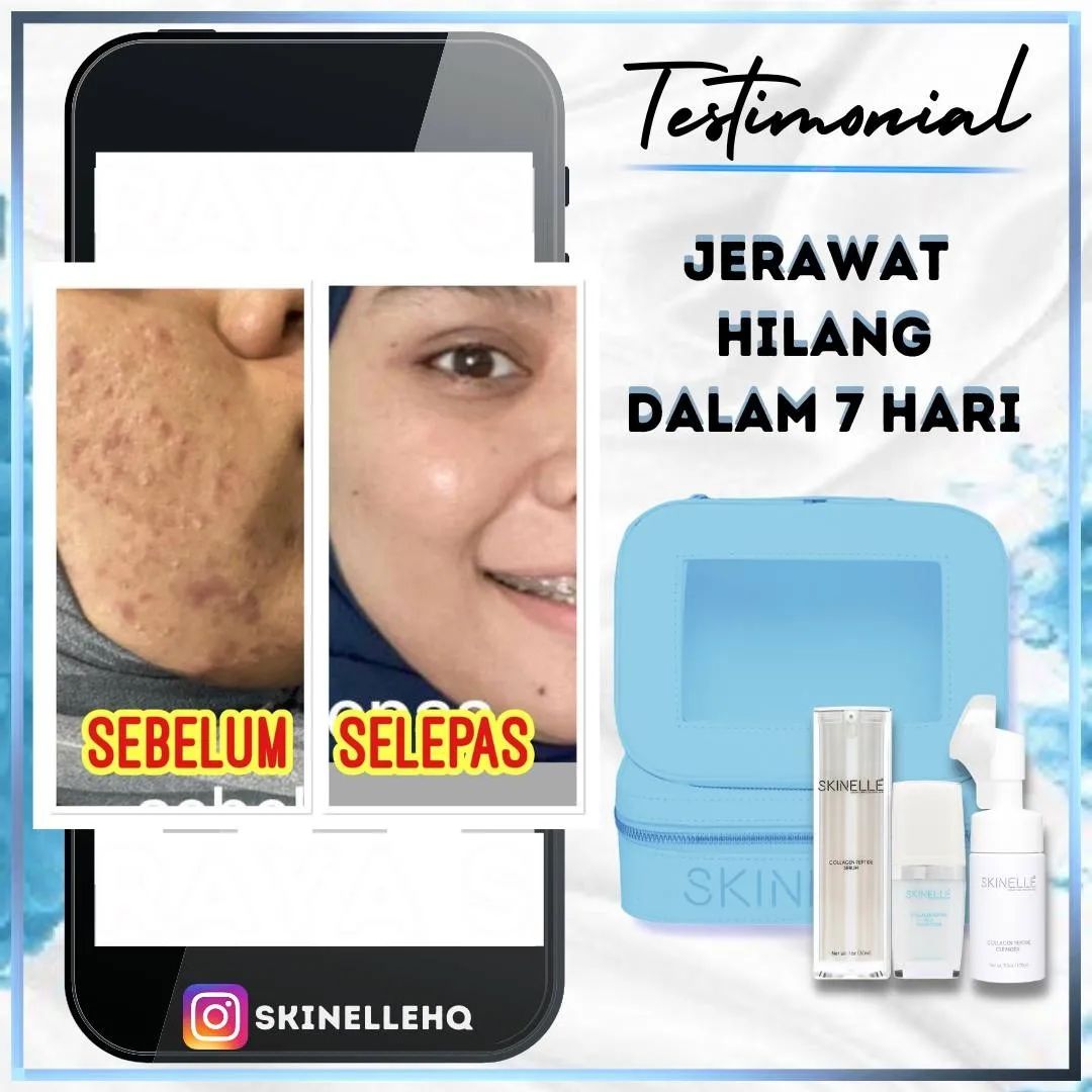 [FAST SHIP] SKINELLE SET JERUNG SET BTS COMBO FOUNDATION SKINELLE ...