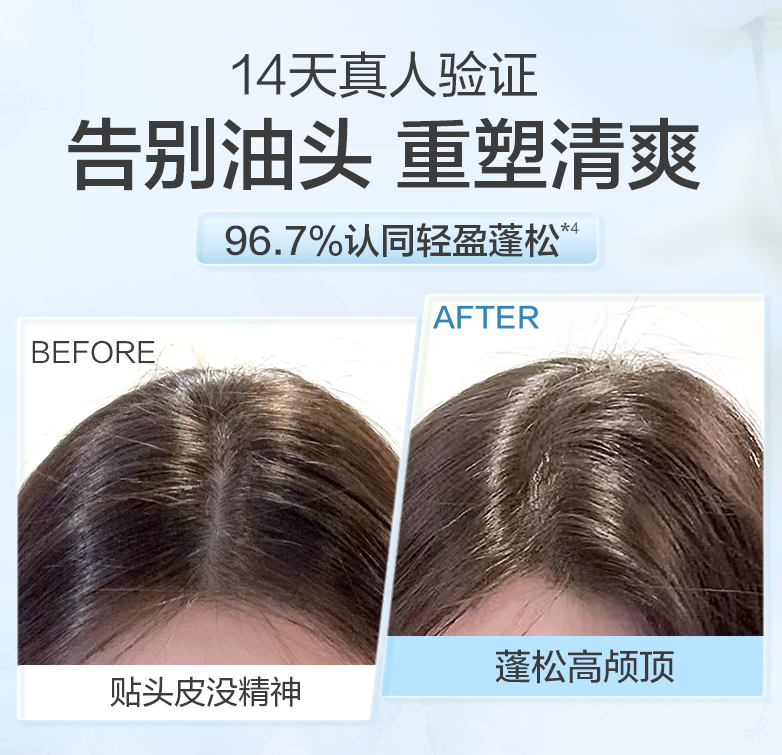 Adolph 阿道夫洗发水祛屑蓬松香氛洗发露518ml 套装控油止痒去屑蓬松 Anti-Dandruff Fluffy Fragrance ...