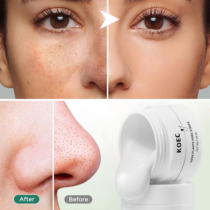 KOEC Blackhead Remover Nose Mask Deep Cleansing Mask Face Pore Strip ...