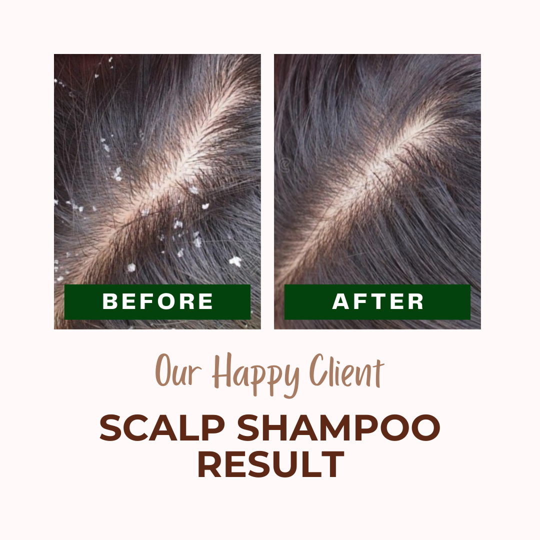 HEADS Botamix Soothing Relief Shampoo for Hair Dandruff Oily Scalp ...