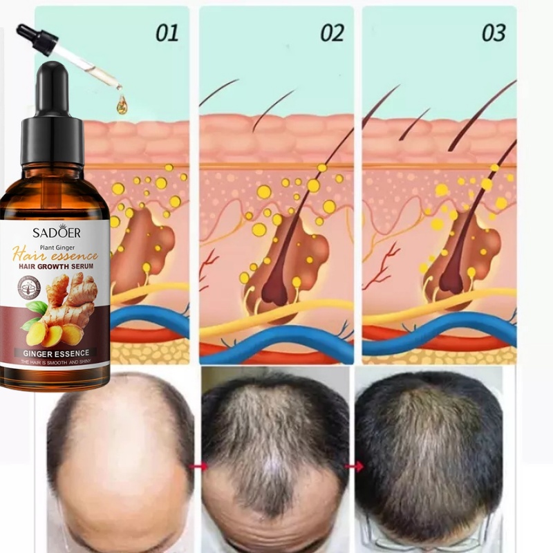 Hair growth serum Lebatkan rambut Serum rambut gugur Hair Grower Fast ...