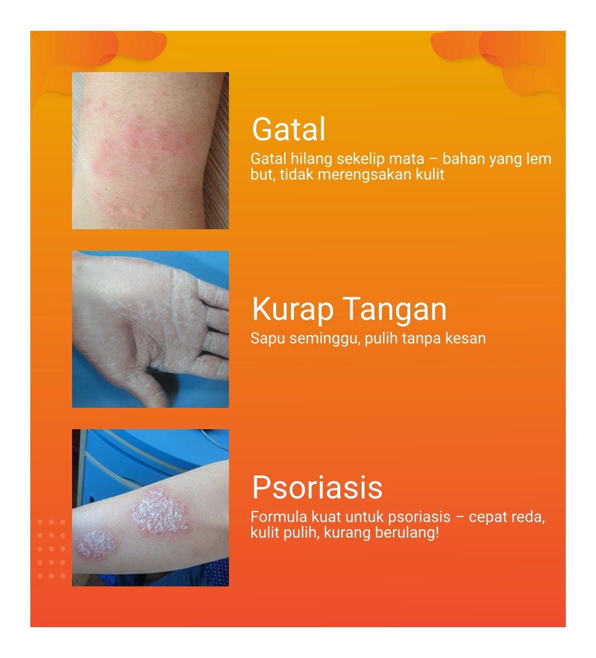𝐎𝐫𝐢𝐠𝐢𝐧𝐚𝐥 Xuandi krim【Ubat gatal kulit】Herba cina Krim Ekzema/Psoriasis ...