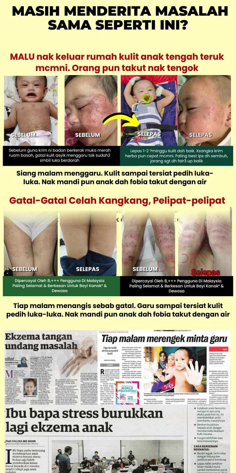 (PROMO) Dr.Ridz Soothing Cream Untuk Masalah Eczema, Psoriasis & Skin ...