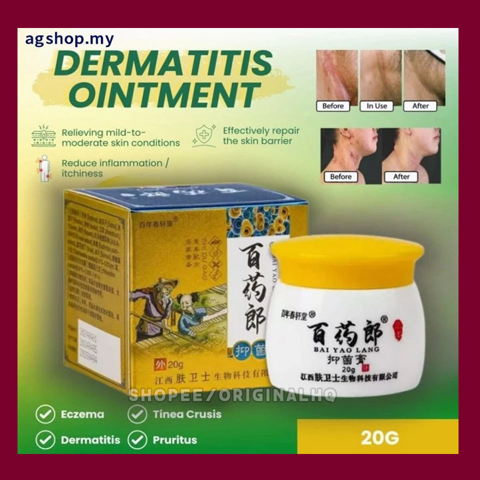 BAI YAO LANG CREAM Treatment of Allergic Skin Itching Eczema Seasonal Allergies Baiyaolang Krim ...