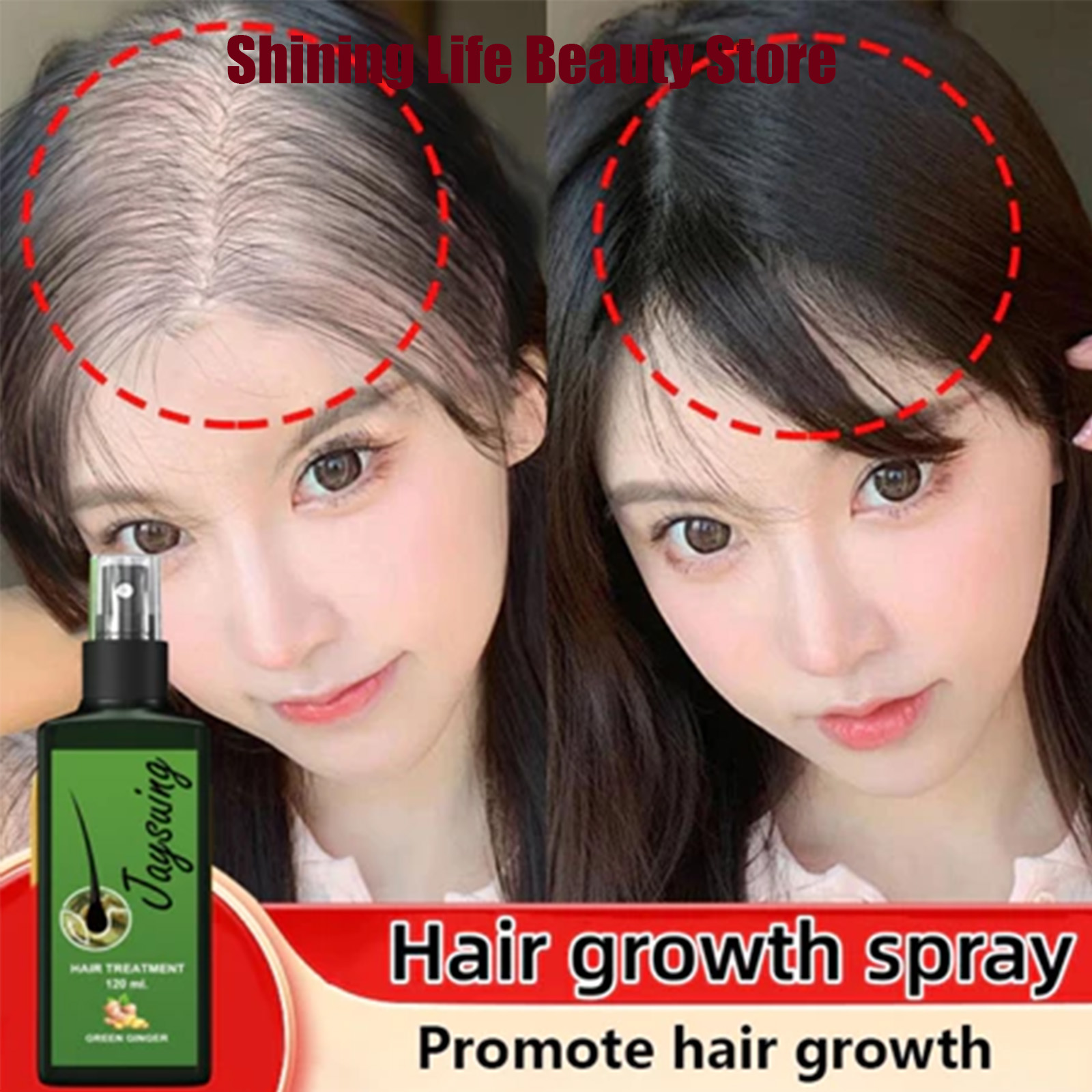 🔥【Crazy Specials】Ginger hair tonic growth spray 120ml Anti hair loss ...