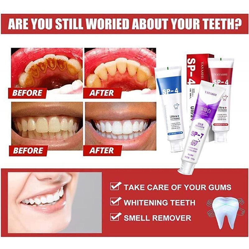 SP-4 Oral Shark Teeth Whitening Toothpaste Brightening Teeth Whiten ...