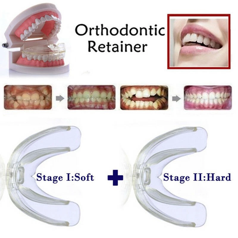 Teeth Orthodontic Appliance Alignment Teeth Retainer Bruxism Mouth ...