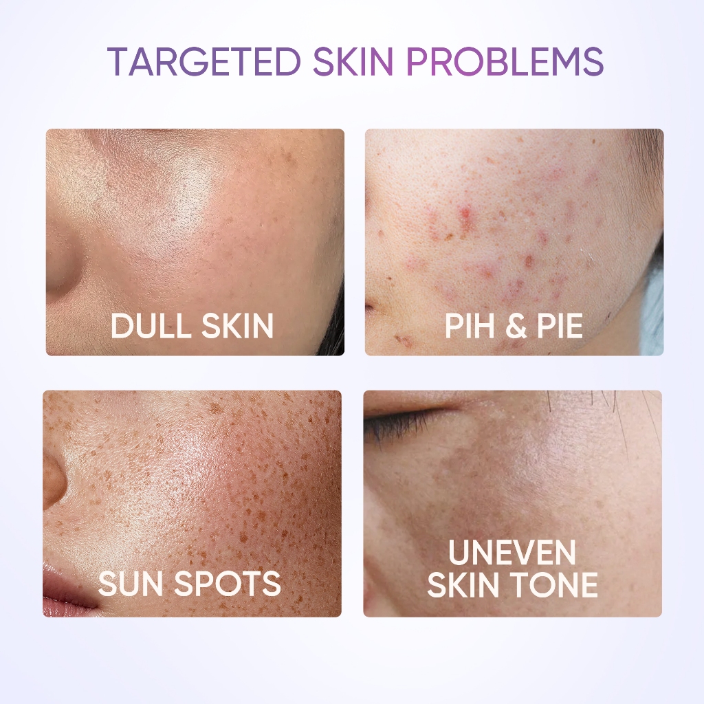 SKINTIFIC Anti Dark Spot Even Tone Radiant Skin Fade acne scars ...