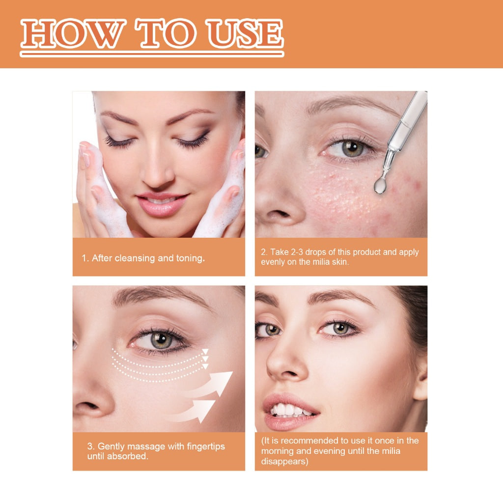Milia Seed Remover Fat Granule Syringoma Milia Remover Grease Grains ...