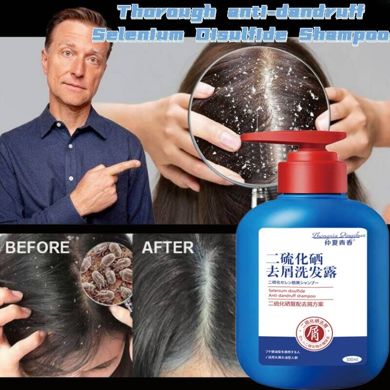 Original Selenium Disulfide 𝗔𝗻𝘁𝗶-𝗗𝗮𝗻𝗱𝗿𝘂𝗳𝗳 𝗦𝗵𝗮𝗺𝗽𝗼𝗼 anti dandruff shampoo ...