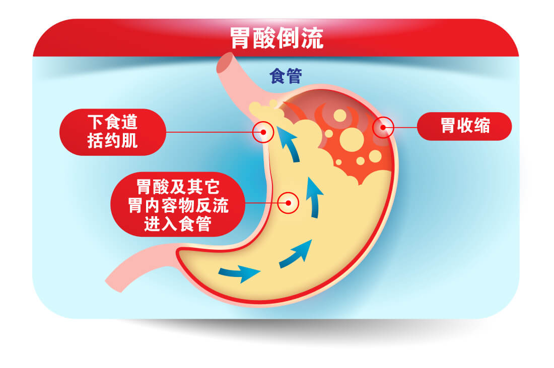 Labo Nutrition GastriCELL Sachets For Stomach 胃痛 胃酸倒流 幽门螺杆菌 涨风 胃灼热 ...
