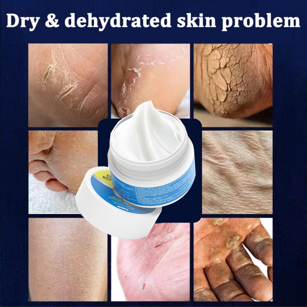 Cracked Heel Repair Cream Removal Dead Skin Hand Feet Care Foot ...