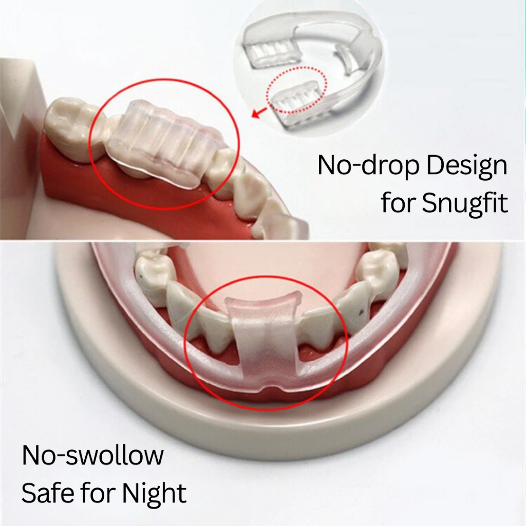 ORIGINAL Dental Mouth Guard Bruxism Splint Night Teeth Tooth Grinding ...