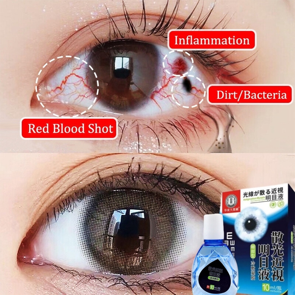 Authentic Japan Eye Drops - Fast-Acting Solution for Dry Eyes, Fatigue ...