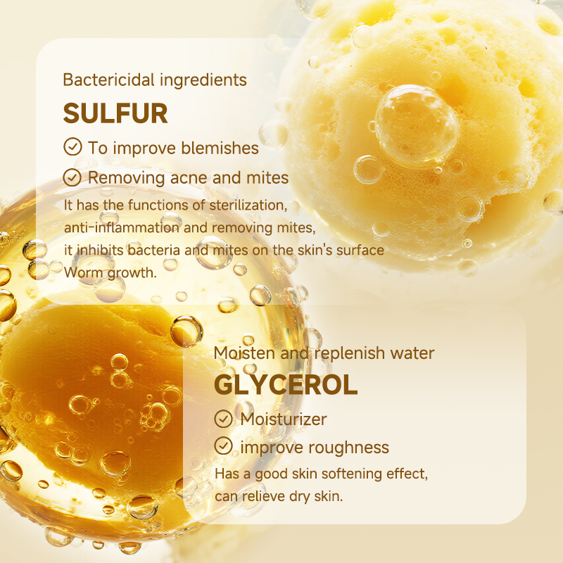 Acne Body Wash Antibacterial Shower Gel Mite Body Wash 500ml sulfur Antibacterial&Cleansing Mite ...
