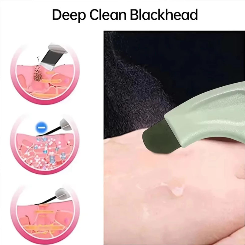 Blackhead Removal Tool Acne Treatment Silicone Exfoliating Care Beauty ...