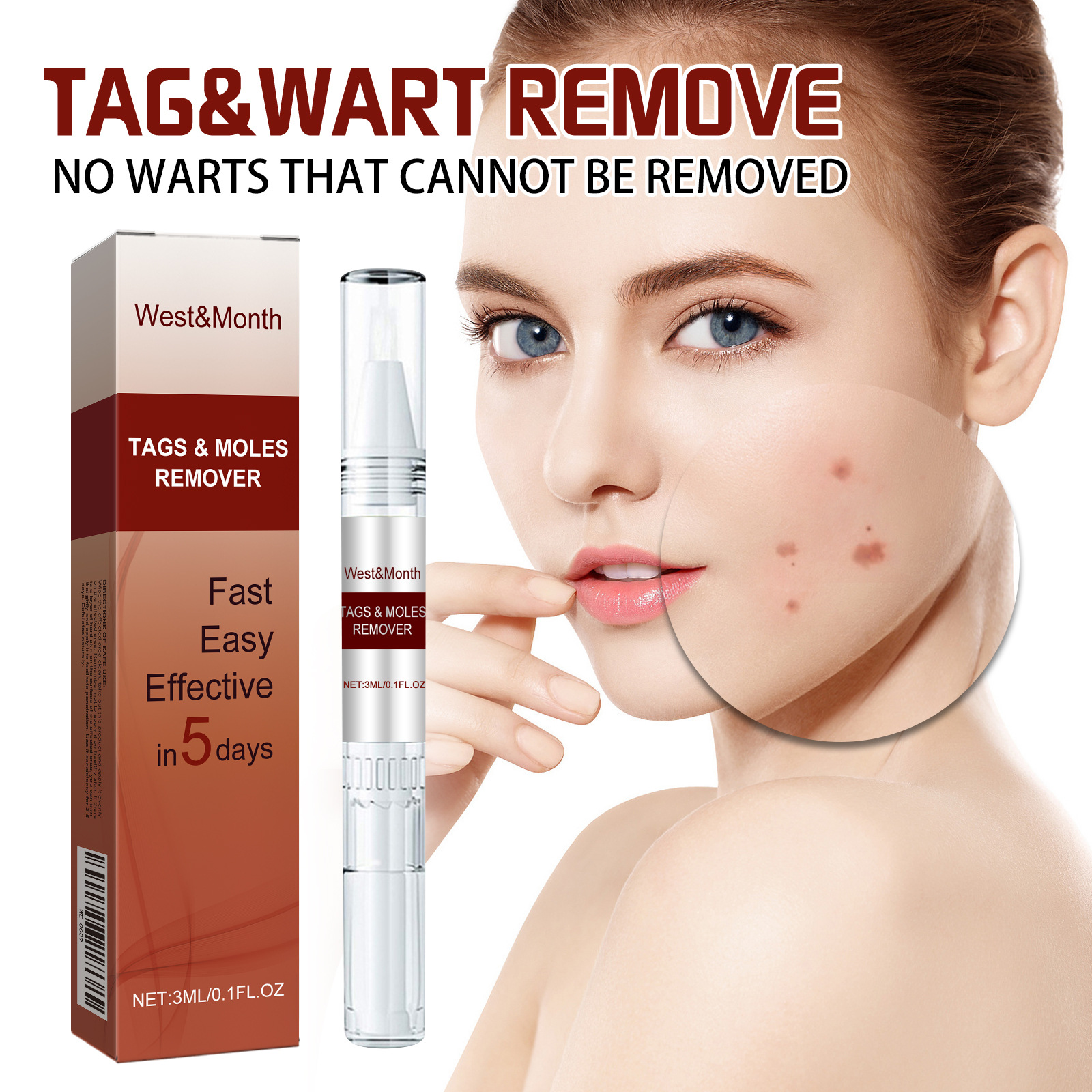 ubat kutil paling berkesan mole remover ubat buang tahi lalat skin tag ...
