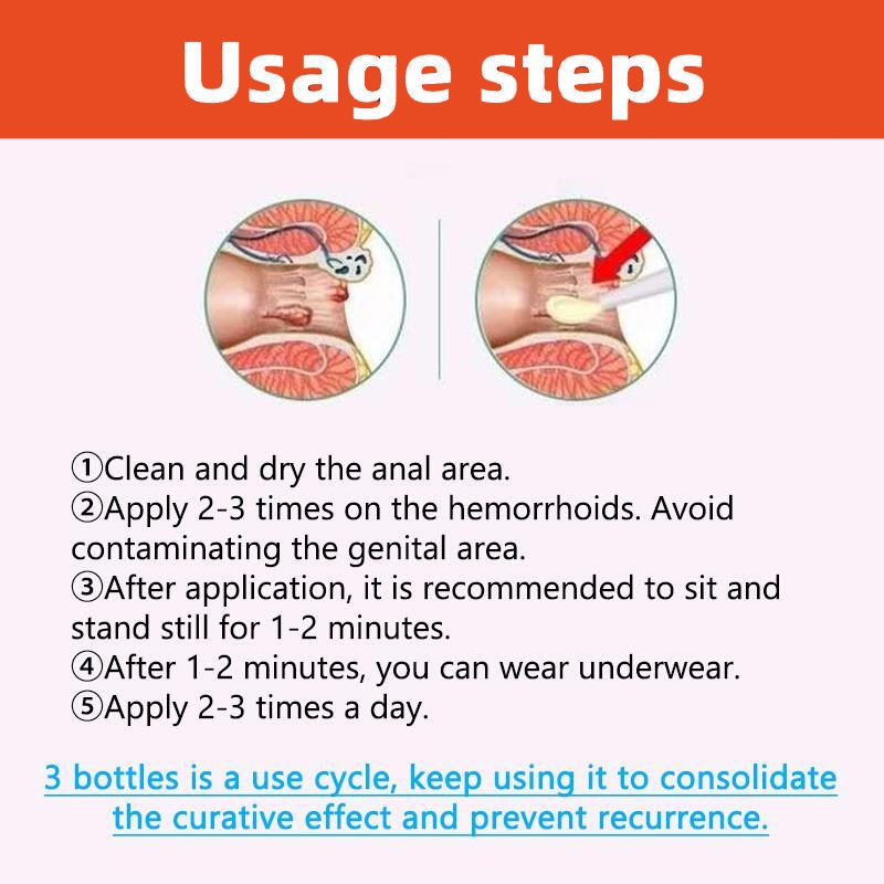 Ubat buasir 100% berkesan Hemorrhoids cream 痔瘡膏 Herba Cina Krim Buasir ...
